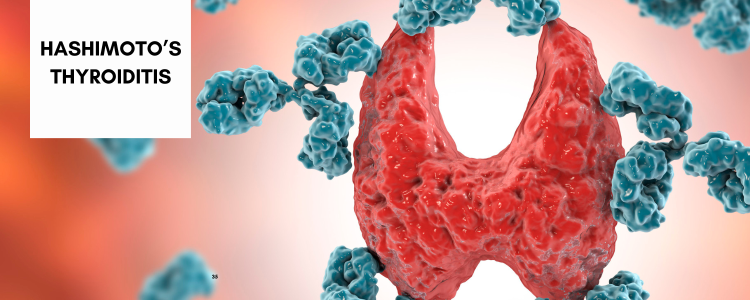 March is Autoimmune Awareness Month - here's what I want you to know ...